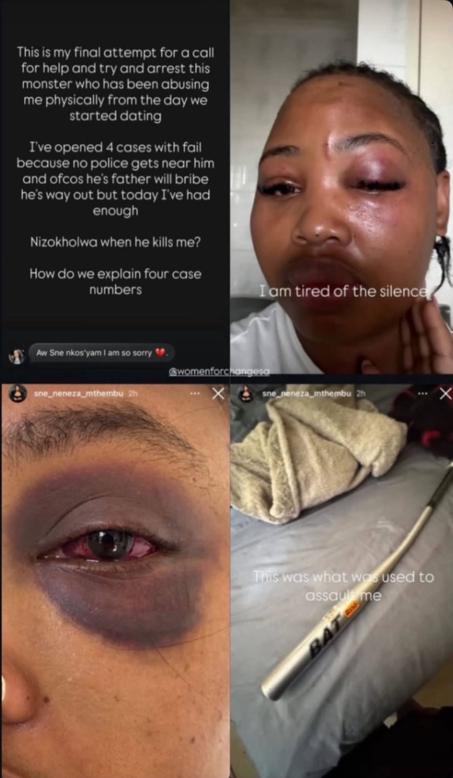 Hairstylist Snenhlanhla Mthembu recovering in ICU while facing assault ...